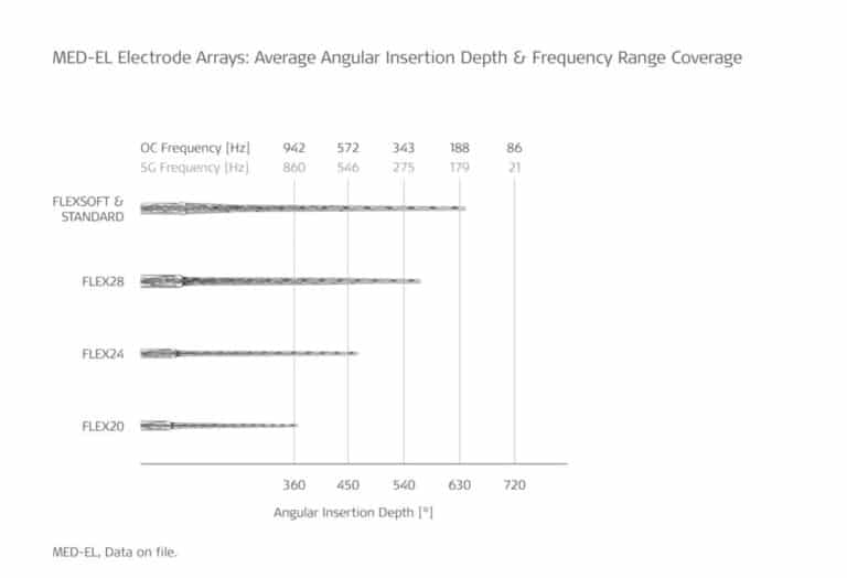 Anatomy-Based Fitting: A New Tool for Improving Place-Pitch Match - MED ...