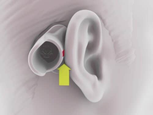 ADHEAR Tips & Tricks for Professionals - MED-EL Professionals Blog