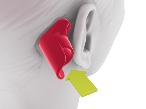 ADHEAR Tips & Tricks for Professionals - MED-EL Professionals Blog