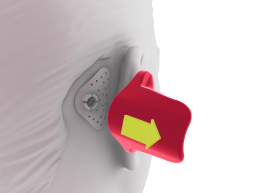 ADHEAR Tips & Tricks for Professionals - MED-EL Professionals Blog