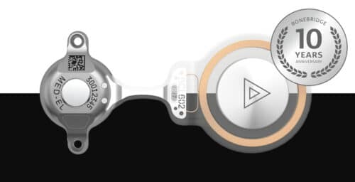 Active, Transcutaneous, and a Decade of Proven Experience: Happy ...