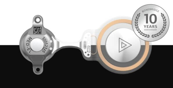 Active, Transcutaneous, and a Decade of Proven Experience: Happy ...