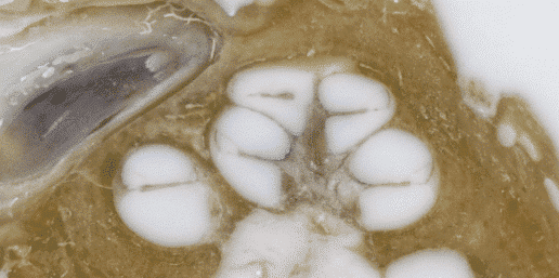 “Thousands of Slices of Anatomical Perfection”: OpenEar Color 3D ...