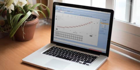 Anatomy-Based Fitting: A New Tool for Improving Place-Pitch Match - MED ...
