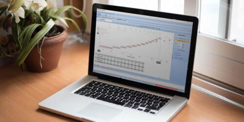 Anatomy-Based Fitting: A New Tool for Improving Place-Pitch Match - MED ...