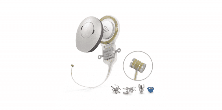 Performance Assessment: VIBRANT SOUNDBRIDGE VORP 503 Middle Ear Implant ...