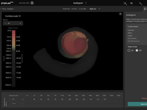 New Features in OTOPLAN: Enhanced Hearing Implant Individualization ...