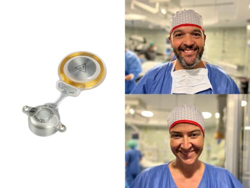 BONEBRIDGE Instead of BAHA: Case Study and Surgical Video - MED-EL ...