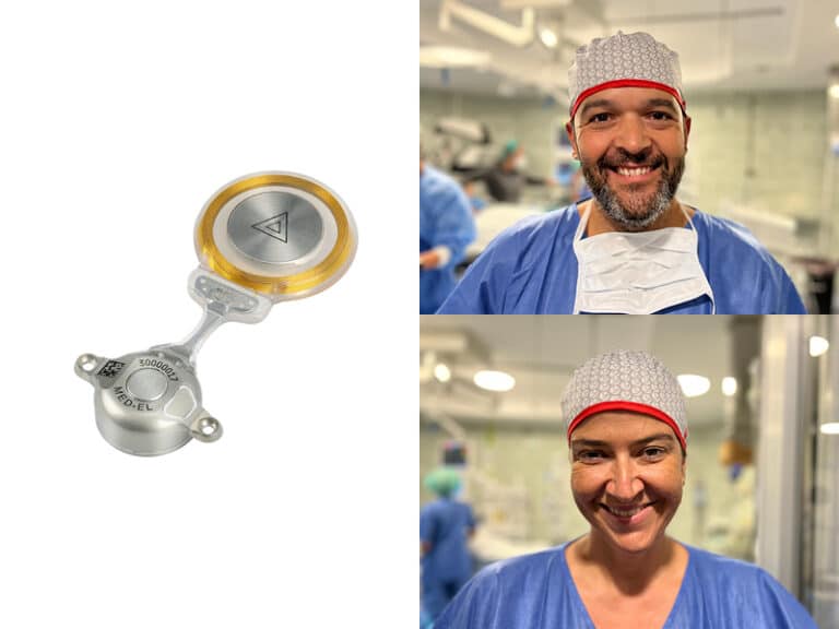 BONEBRIDGE Instead of BAHA: Case Study and Surgical Video - MED-EL ...