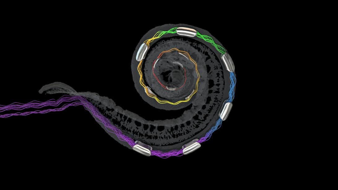 Music and Sound Quality With MED-EL Cochlear Implants, Part 2 - MED-EL ...