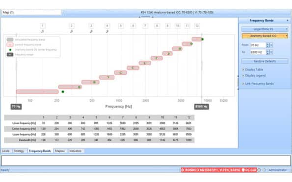 The MED-EL Spotlight: Implementing Anatomy-Based Fitting into Your ...