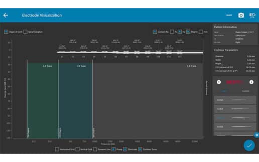The MED-EL Spotlight: Implementing Anatomy-Based Fitting into Your ...
