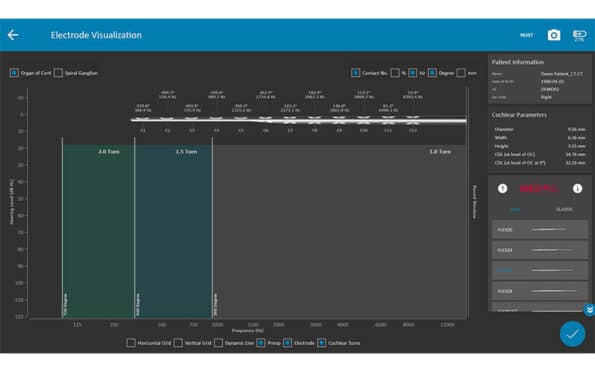 The MED-EL Spotlight: Implementing Anatomy-Based Fitting into Your ...
