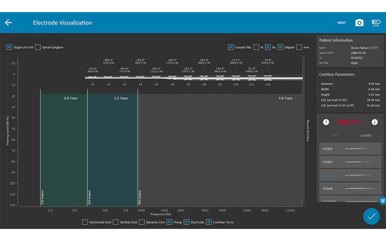 The MED-EL Spotlight: Implementing Anatomy-Based Fitting into Your ...