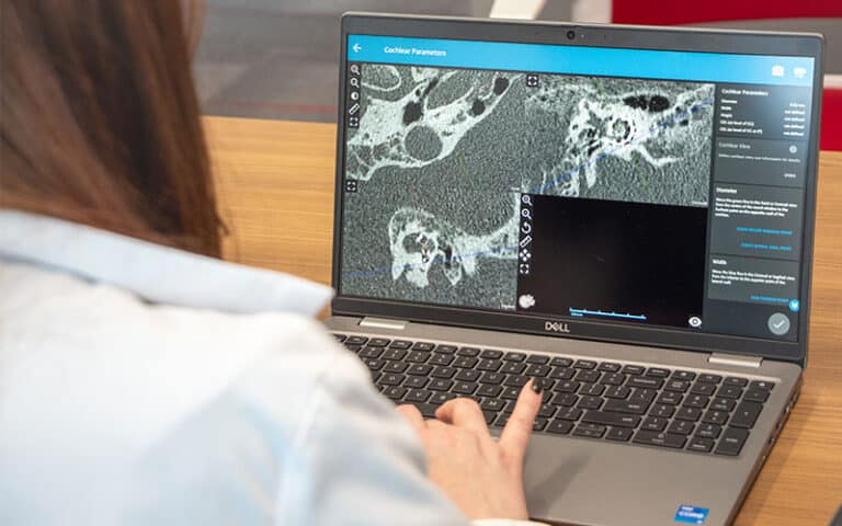 Getting Started with OTOPLAN On Demand - MED-EL Professionals Blog