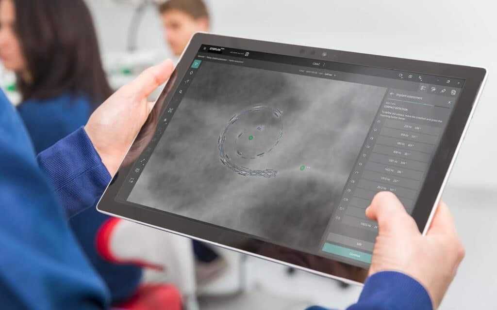 New Milestones Reached in Patient-Centered Cochlear Implantation & Care ...