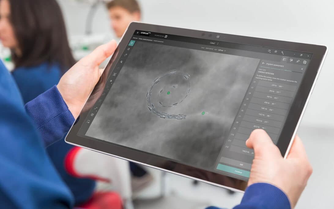 New Milestones Reached in Patient-Centered Cochlear Implantation & Care ...