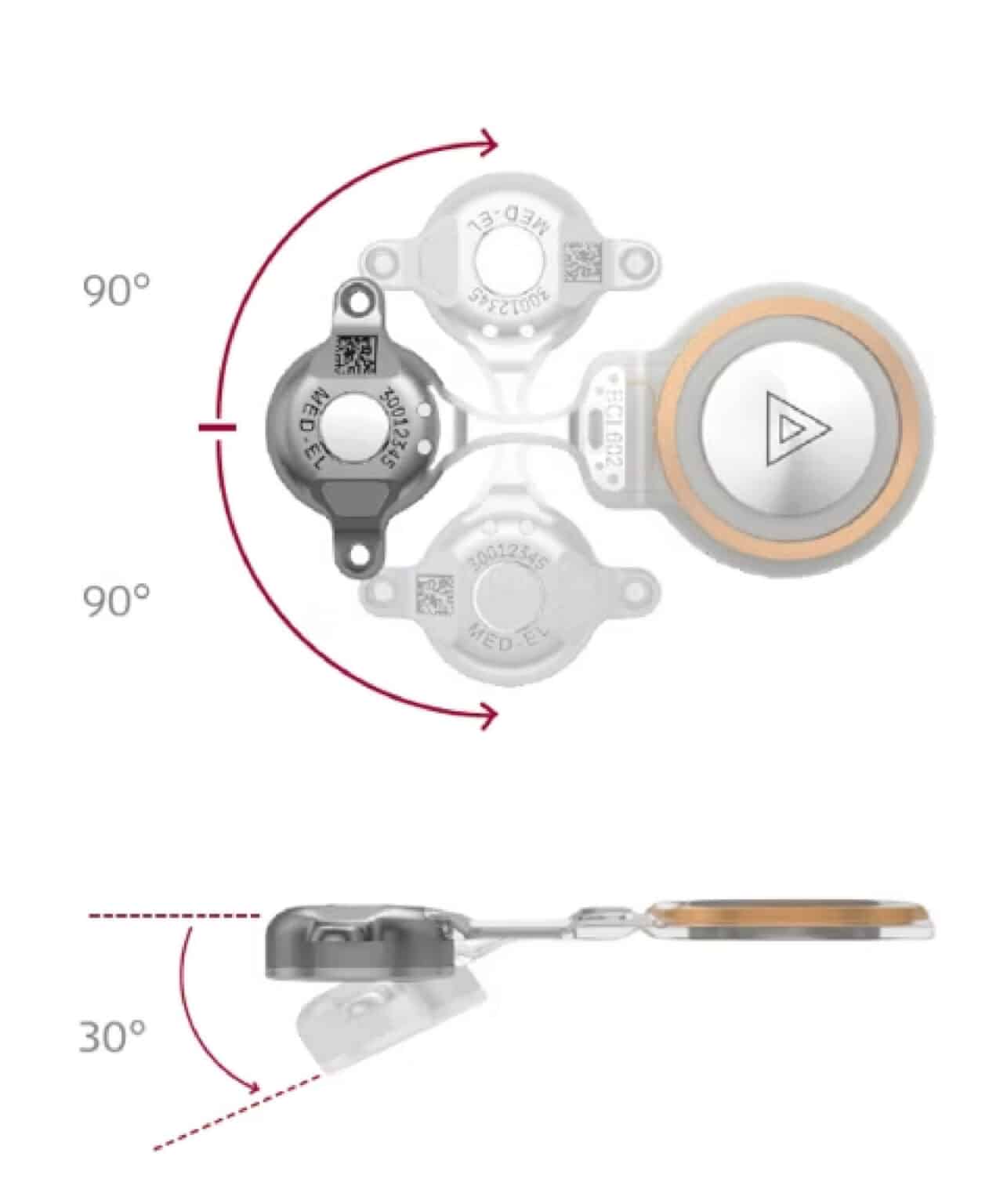 The MED-EL Spotlight on BONEBRIDGE: Surgical Insights on Optimizing Clinical Practice & Outcomes ...