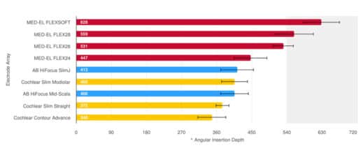 9 Reasons Why Cochlear Implant Electrodes Matter - MED-EL Professionals ...