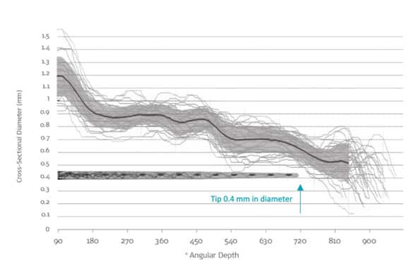9 Reasons Why Cochlear Implant Electrodes Matter - MED-EL Professionals ...