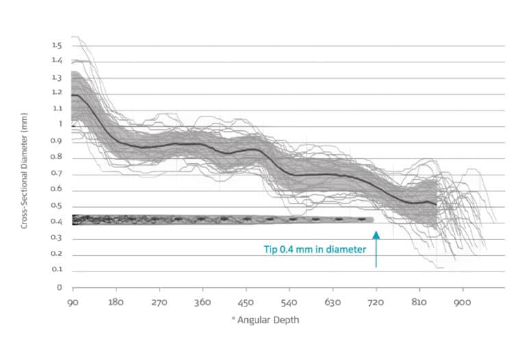 9 Reasons Why Cochlear Implant Electrodes Matter - MED-EL Professionals ...