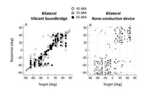 VIBRANT SOUNDBRIDGE: The Better Solution for Mixed Hearing Loss? - MED ...