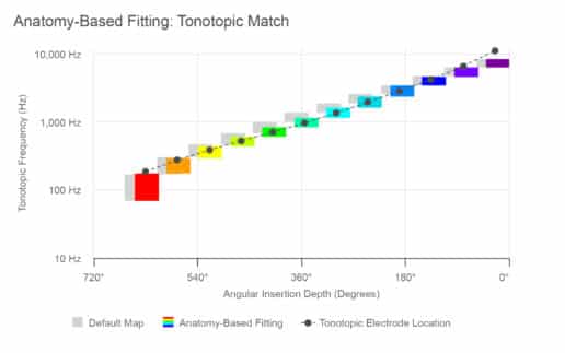 Anatomy-Based Fitting: A New Tool for Improving Place-Pitch Match - MED ...